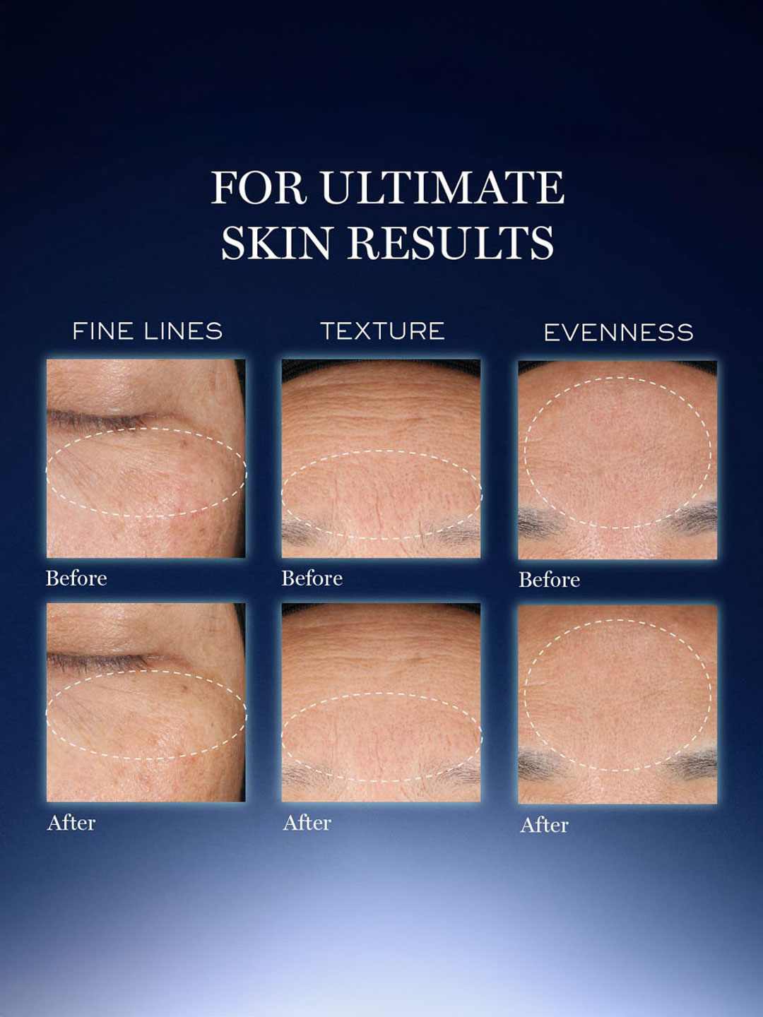 Genifique Ultimate Youth Activating Serum With Beta Glucan For Skin